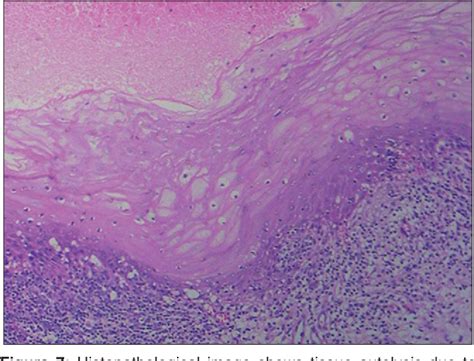 A Review Of Artifacts In Histopathology Semantic Scholar