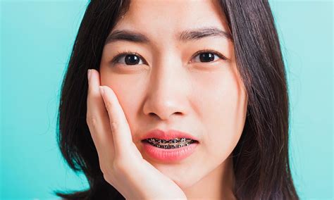 Braces Faq Do Braces Hurt Myorthodontist