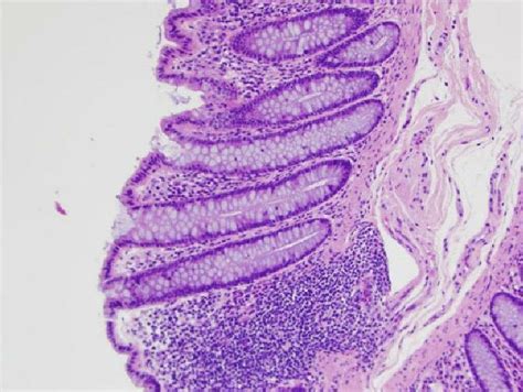 Normal Colonic Mucosa Cell 14 Download Scientific Diagram