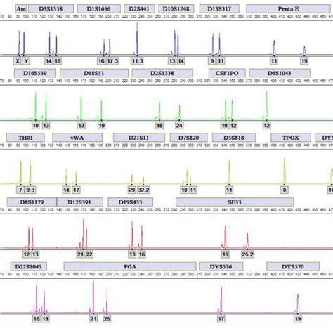 Representative Electropherogram Developed By The Ande System