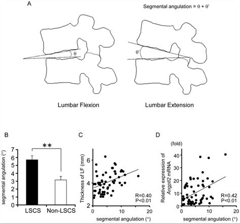 A Radiograph Illustrating The Measurement Of Lumbar Segmental Download Scientific Diagram