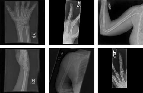 Examples Of Synthetic X Rays Generated By The Process Described In This