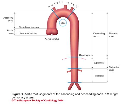 What Is Enlarged Aortic Root At Frank Thill Blog