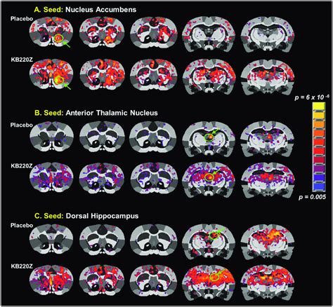 Kb220z Increases Functional Connectivity In The Rat Brain Reward System Download Scientific