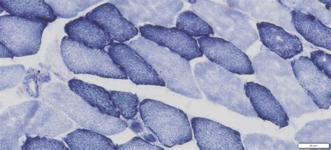 Vitroview™ Nadh Tr Histochemistry Stain Kit For 50~100 Slides