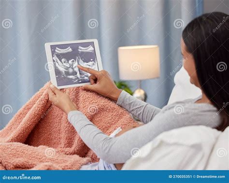 Digital X Rays Pregnancy