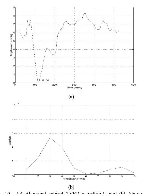 figure 10 from identification of transient visual evoked potential latency using spectral
