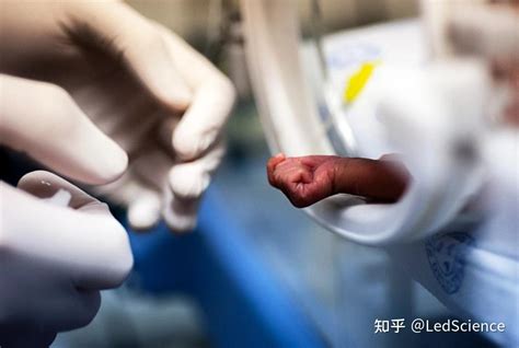 人造子宫技术有突破，是否批准人体实验引发伦理争议 知乎