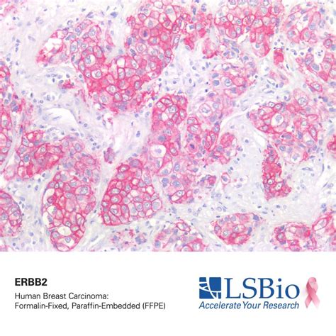 Her2 Erbb2 Or Human Epidermal Growth Factor Receptor 2 Is A