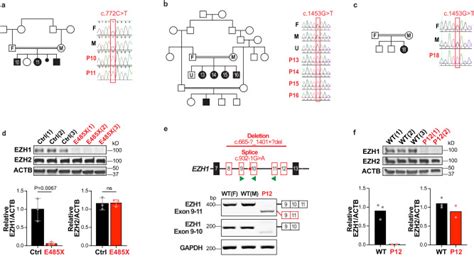 Gain And Loss Of Function Variants In Ezh1 Disrupt Neurogenesis And Cause Dominant And Recessive
