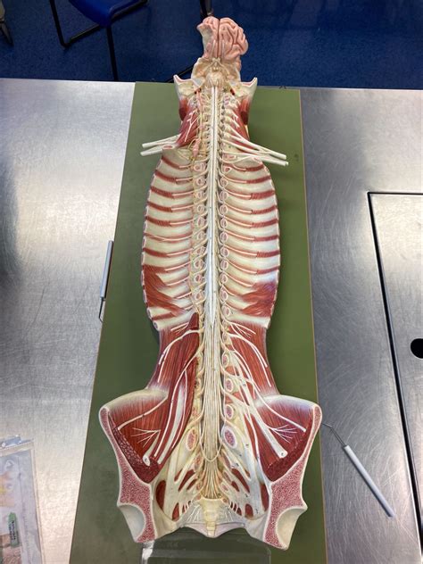Spinal Cord Plexuses Diagram Quizlet