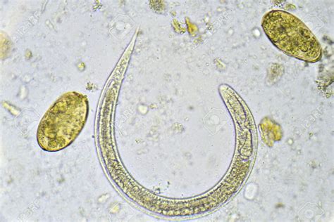 Resultado De Imagen Para Strongyloides Stercoralis