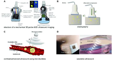 Ultrasound Technology Applications In Medicine A See In Figure 1 In Download Scientific