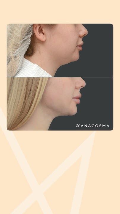 Як отримати чіткий контур обличчя овал обличчя Youtube