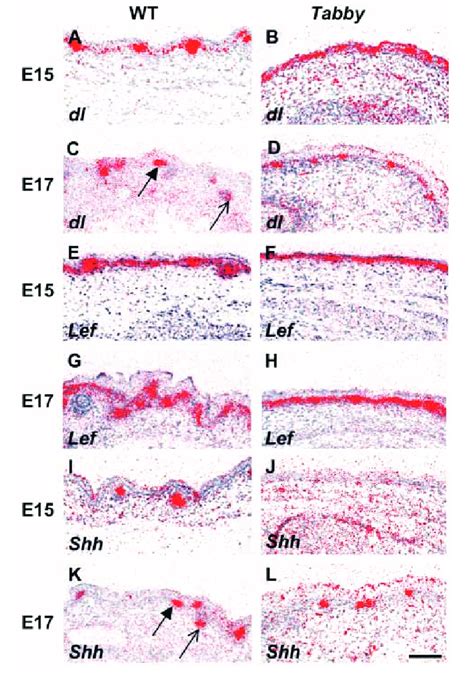 Comparison Of Ectodermal Gene Expression Patterns In Wildtype And Ta