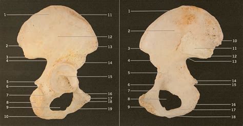 Right Coxal Bone Lateral And Medial View Diagram Quizlet