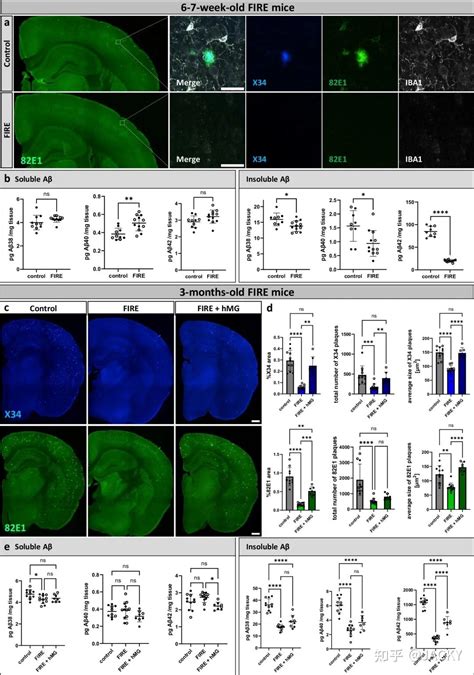 小胶质细胞：阿尔茨海默病进展中的双刃剑 知乎