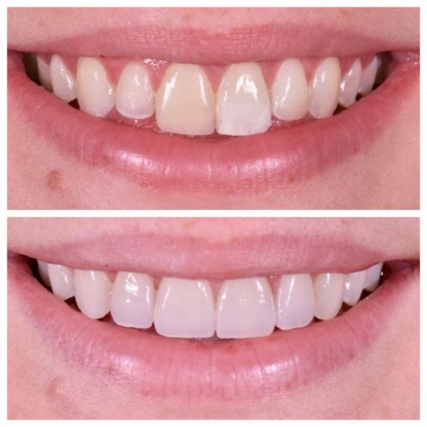 Some Free Ce Courses