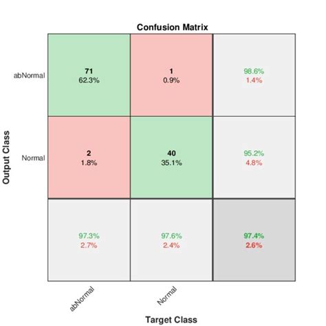 the confusion matrix of pca classifier on octid dataset for diagnosing