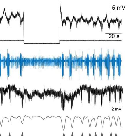 Effect Of Ns Neuron Upon The Rhythmic Activity Of T Cells During Download Scientific Diagram