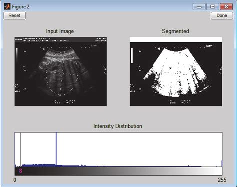 Conversion Of Grayscale Image To Binary Image Based On Threshold