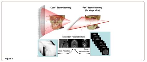 Applications Of Cone Beam Computerized Tomography In Orthodontics A Review