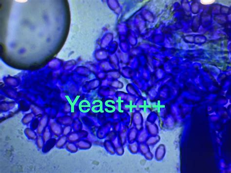 Some Photos Of Examples Of Cytology King Street Veterinary Hospital