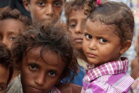 Cinco Millones De Niños Amenazados De Hambruna En Yemen Por Guerra