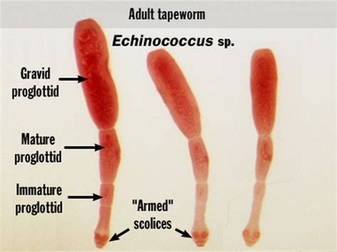 Echinococcus Pictures