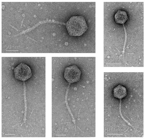 Phages Adapt To Bacterial Restriction And Modifications