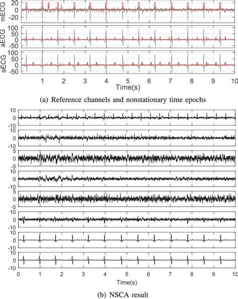 Temporally Nonstationary Component Analysis Application To Noninvasive