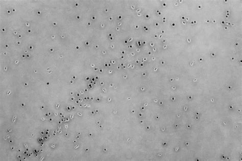 Clostridium Difficile Discounts Outlet Th