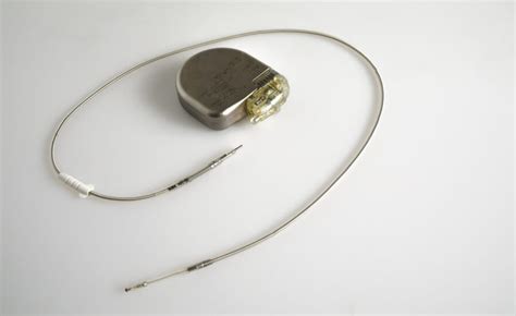 Automated Implantable Cardioverter Defibrillator Longmore Clinic