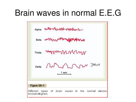 Ppt Eeg And Sleep Powerpoint Presentation Free Download Id 6879601