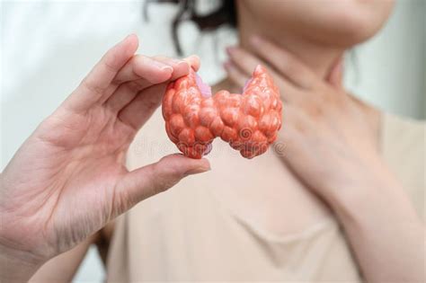 Hyperthyroidism Overactive Thyroid Thyroid Lymphoma Asian Woman With Thyroid Gland Human