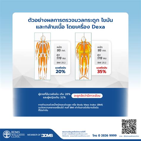 Dexa Scan โปรโมชั่น Bdms Wellness Clinic
