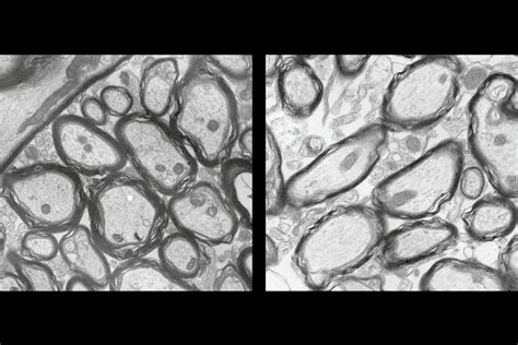 Prosocial Effects Of Oxytocin Are State Dependent And More The Transmitter Neuroscience News