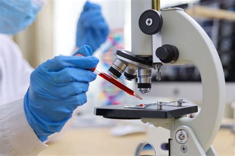 Anemia Prime Med Labs