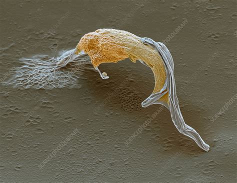 Amoeba Fruiting Body Sem Stock Image C0562215 Science Photo Library