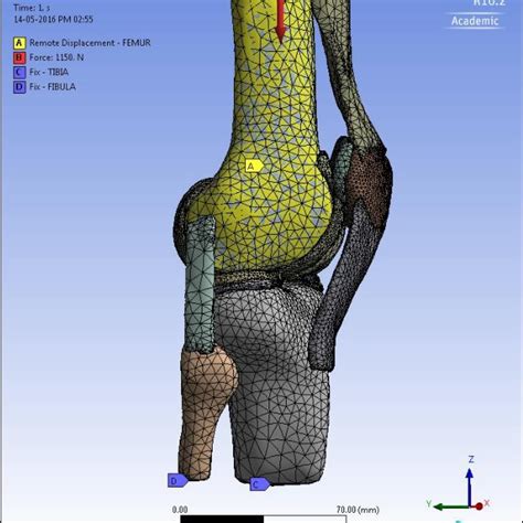 Pdf Finite Element Analysis Of A Human Knee Joint