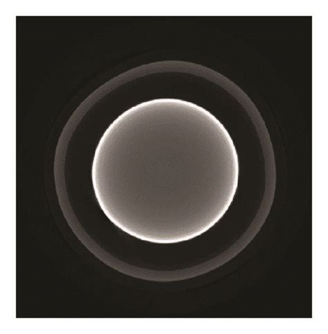 A Ct Raw Data Image And B Ct Slice After Using Edge Preserving