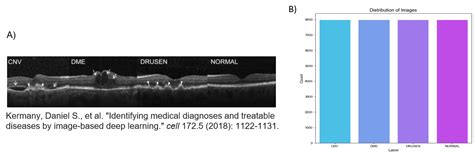 Github Marghafscreening Of Common Retinal Diseases With Deep Learning