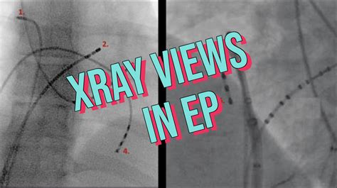 Xray Views In Ep Ep Essentials