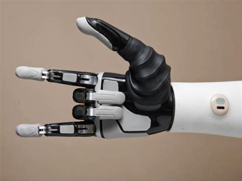 Ai Prosthetics A New Era Of Mobility Ai News Bee
