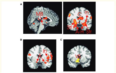 Prediction Error Encoding A Controls Exhibited Prediction Error Download Scientific Diagram