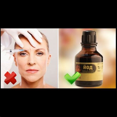 Дерматоложката ми каза какъв елексир с йод да си правя за бръчките и петната по лицето след