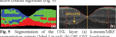 figure 9 from automated segmentation of retinal layers in oct imaging