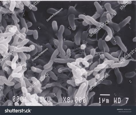 3148件の「bacteria Electron Microscope」の画像、写真素材、ベクター画像 Shutterstock