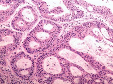 Skenes Gland Histology