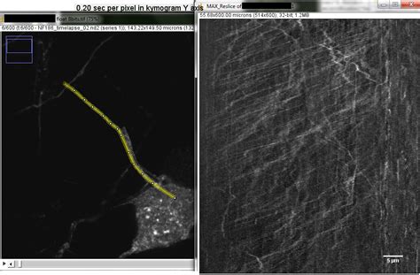 Kymogram In Nikon Demo